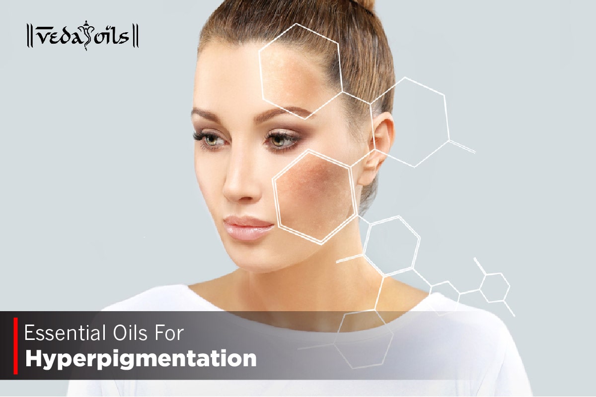 11 Best Essential Oils For Hyperpigmentation – VedaOils