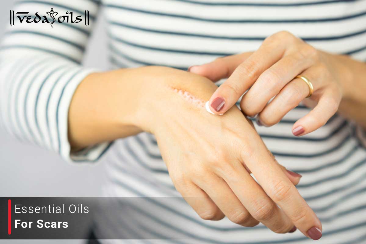 10 Best Essential Oils For Scars | Scar Treatment Essential Oils – VedaOils