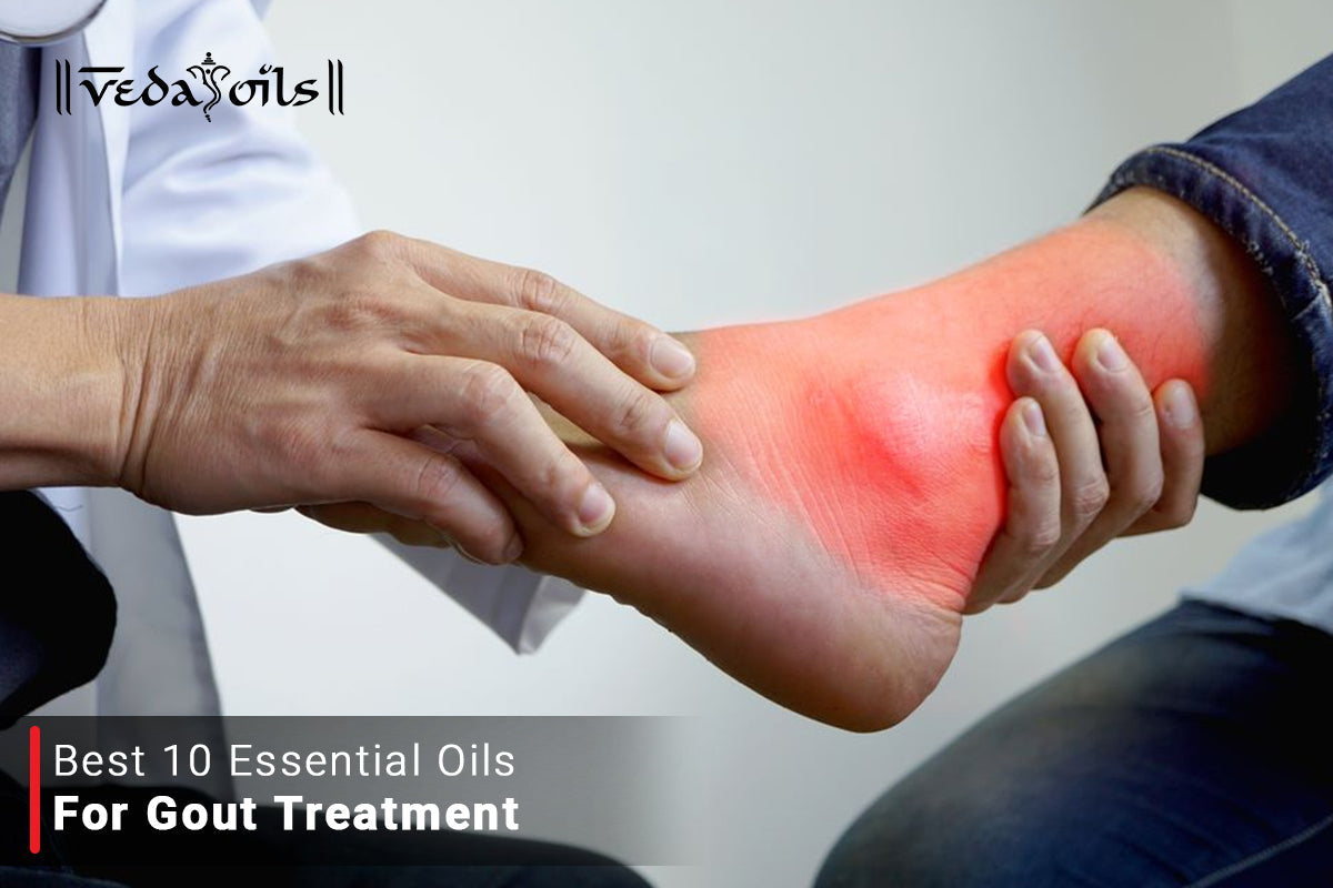 10 Best Essential Oils For Gout - Natural Pain Relief – VedaOils