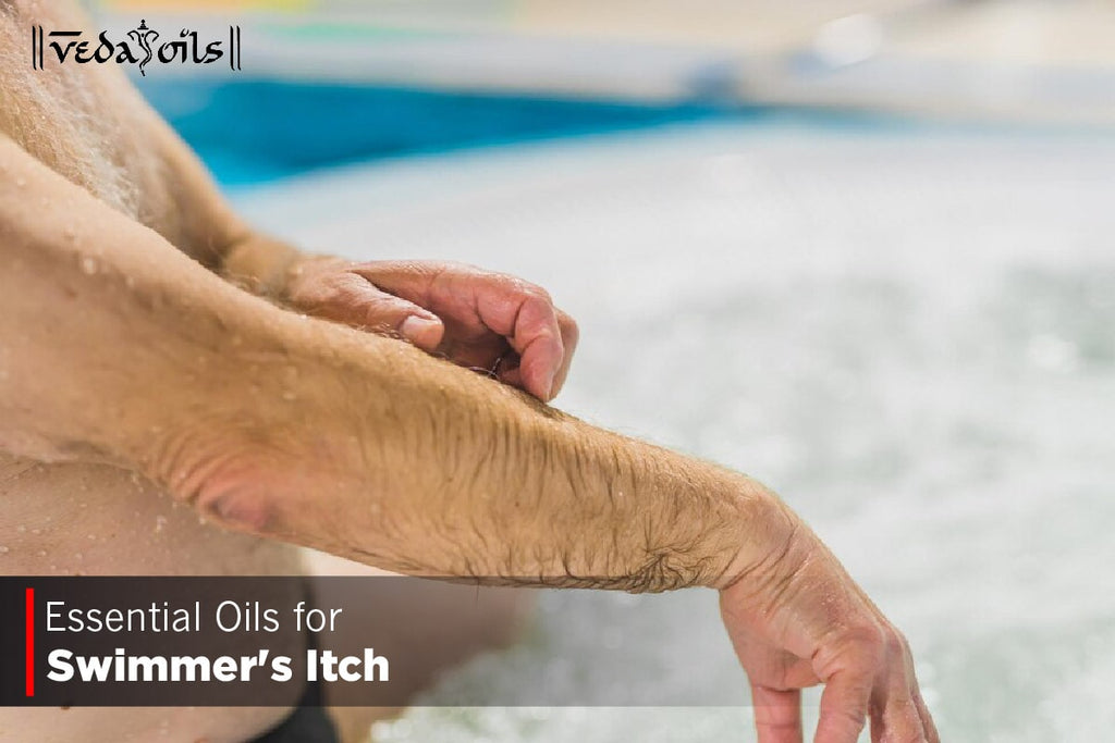5 Best Essential Oils For Swimmer's Itch - Swimmer's Itch Treatment ...