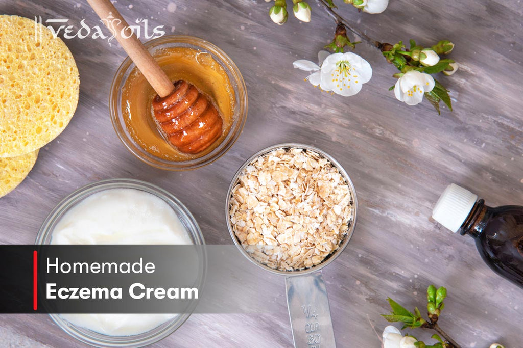 7 Homemade Eczema Creams - Make Your Own – VedaOils