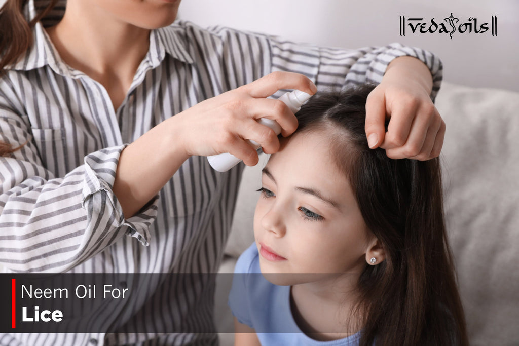 Neem Oil For Head Lice Treatment - Benefits & Uses – VedaOils