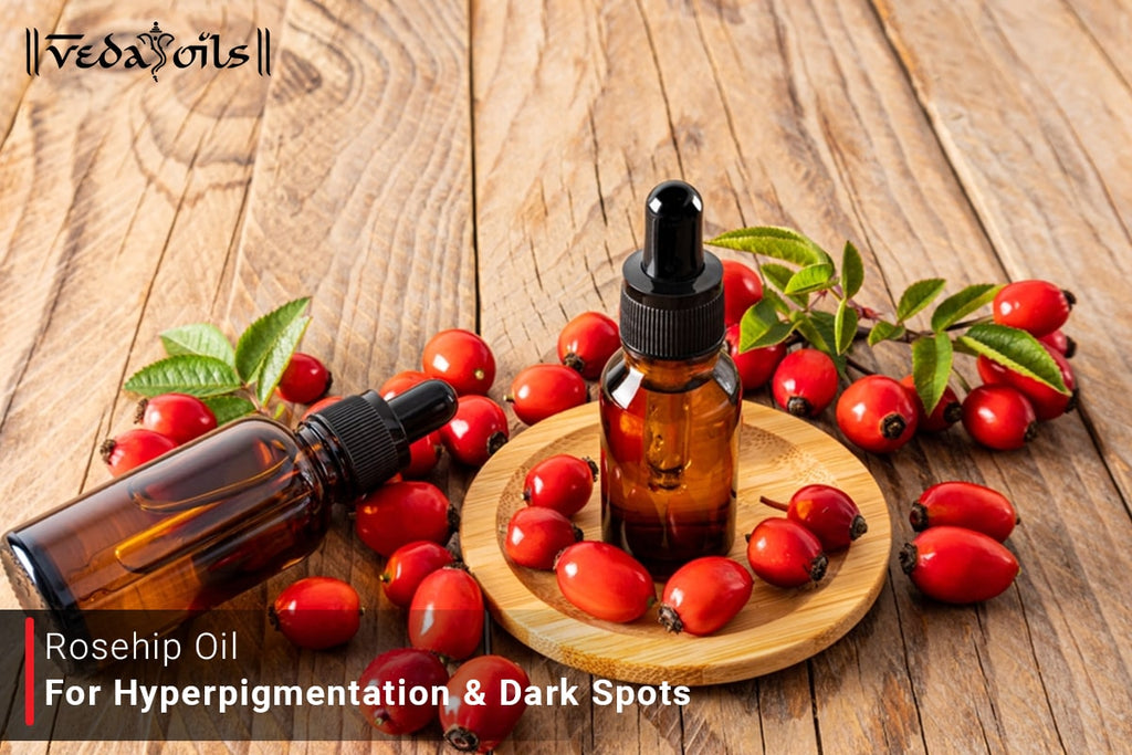 Rosehip Oil For Hyperpigmentation - Benefits & How To Use – VedaOils